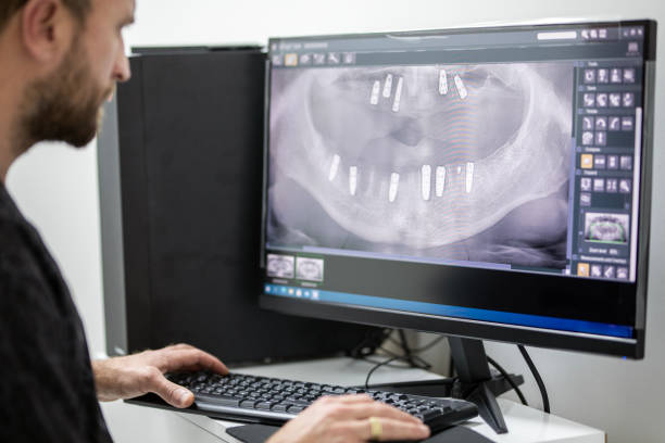 New Extraoral Chairside Prosthesis Scanning Protocol for Edentulous ...