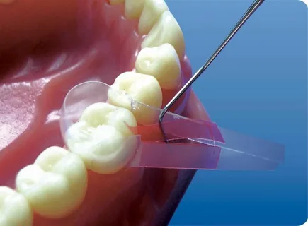 Nuances of Contact Point Restoration
