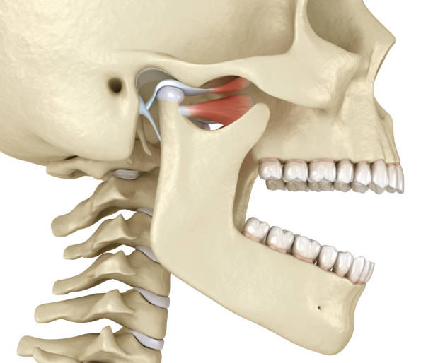 Study on Unilateral TMJ Discectomy for Specific Intra-articular Conditions