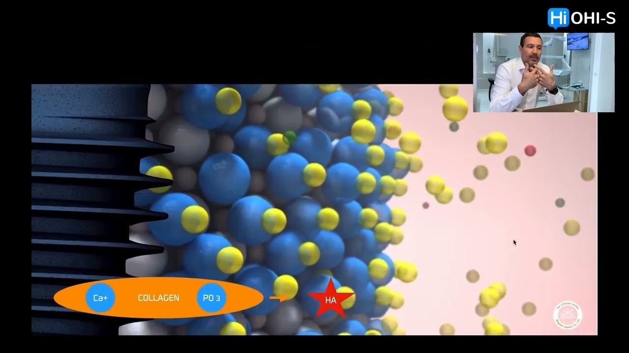 Immediate implant placement. Everything you need to know
