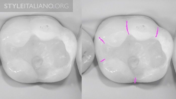 Main Lines of Occlusal Anatomy