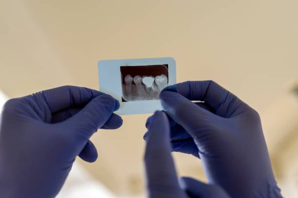 Morphologic Analysis of Mandibular First Molar Root Canals Using Micro-CT