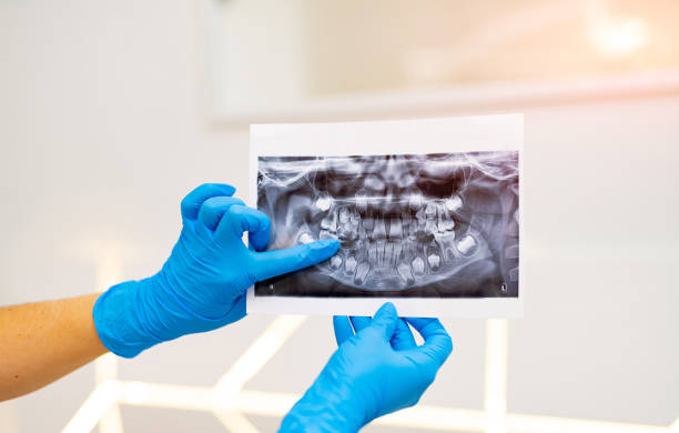 Bibliographic Analysis of Endodontic Research Using Micro-CT Over 25 Years