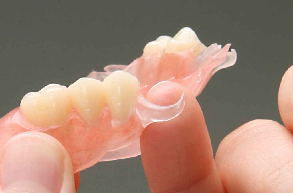Clasp denture fixation systems