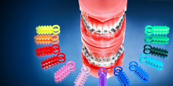 Non-compliant upper molar distalization, pros and cons of different ...