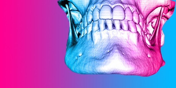 Expansion or extraction in orthodontics?