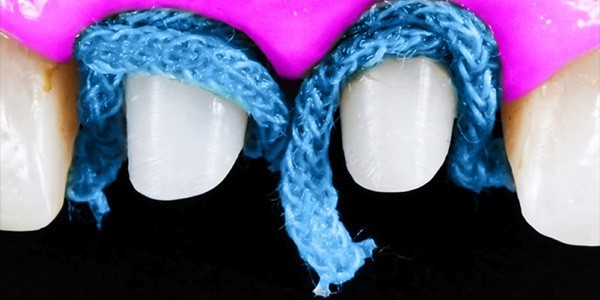 Aesthetic Evolution: Ideal integration of orthopedic structures for ...