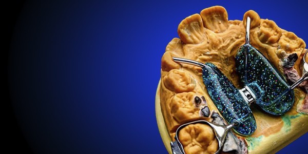 Non-Surgical Mid-Facial Expansion with Micro-Implant (MI) Assisted ...