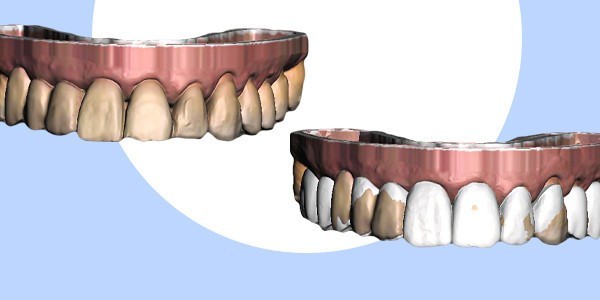 Advance Smile Design 3D