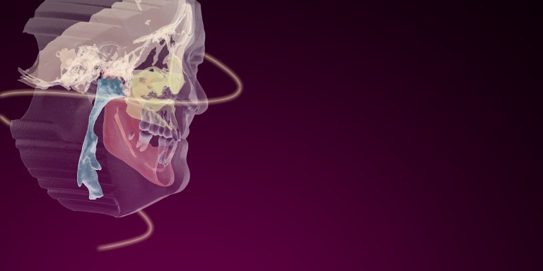 Webinar on maxillofacial ultrasound anatomy, MRI and USG of the TMJ