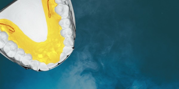 Stabilization appliance and full mouth restorations