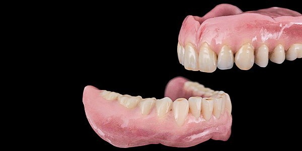 How to Achieve Suction in a Lower Denture by following Dr. Jiro Abe`s SEMCD technique. Part 1