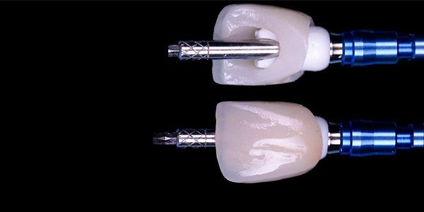 Maxillary sinus augmentation: 10 modern techniques