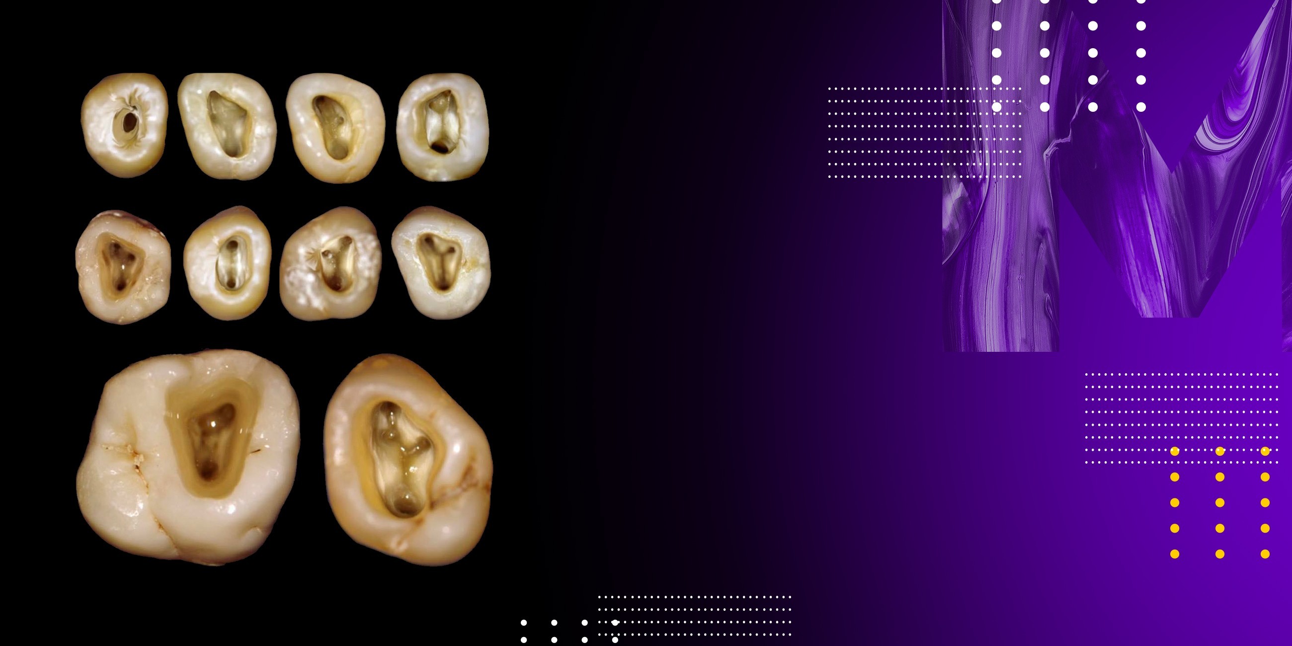Odontometria: Anatomia apical fisiológica