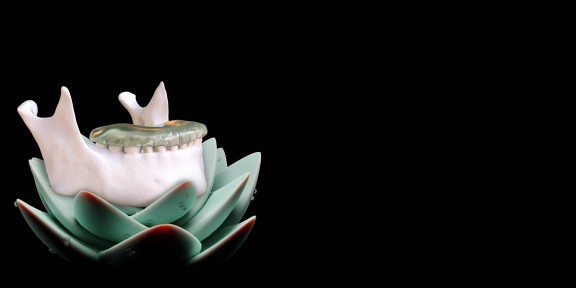 Bruxism treatment: splint, drug treatment, botulinum therapy