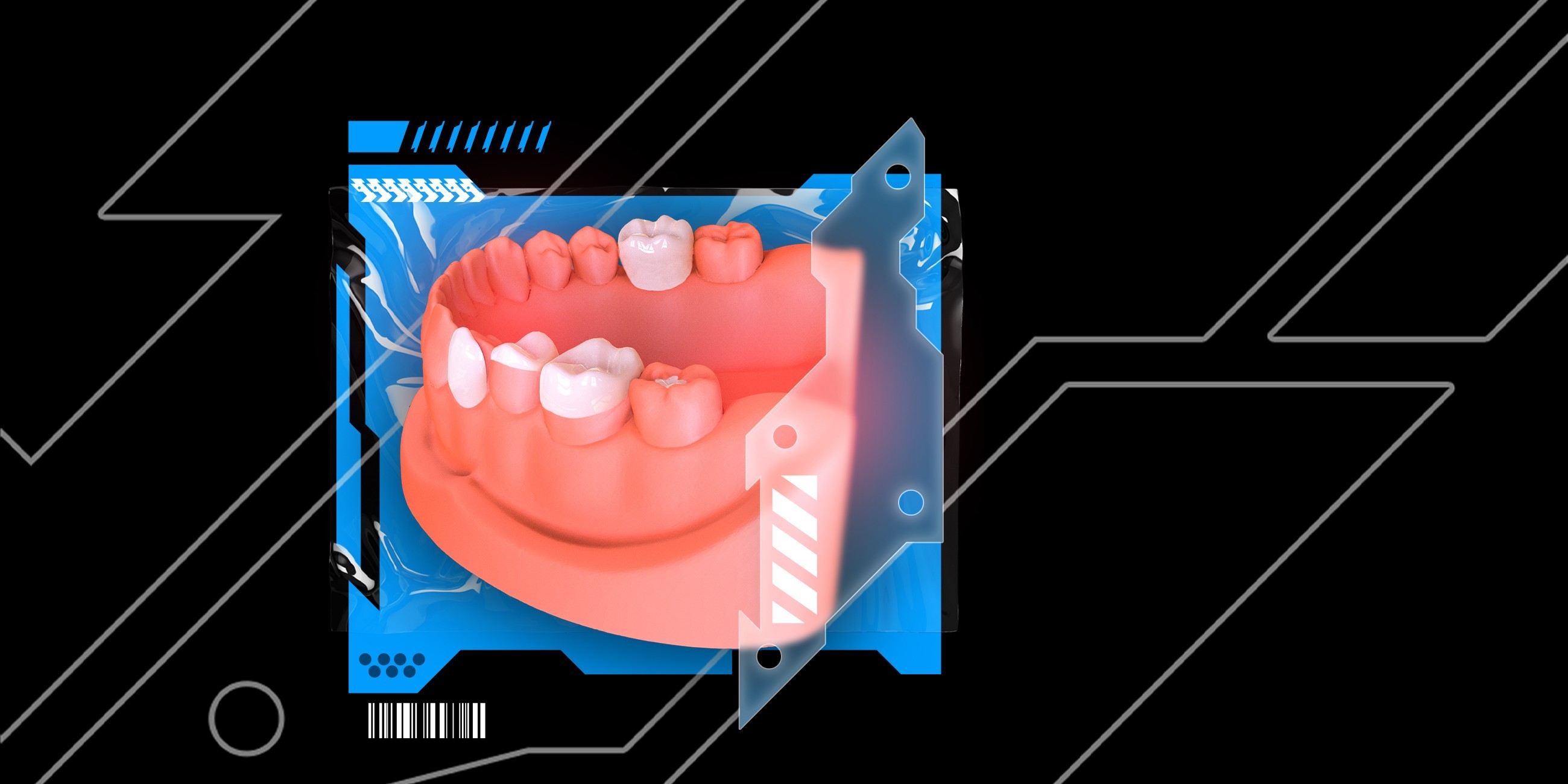 Webinar on adhesion and its effect on restorative procedures