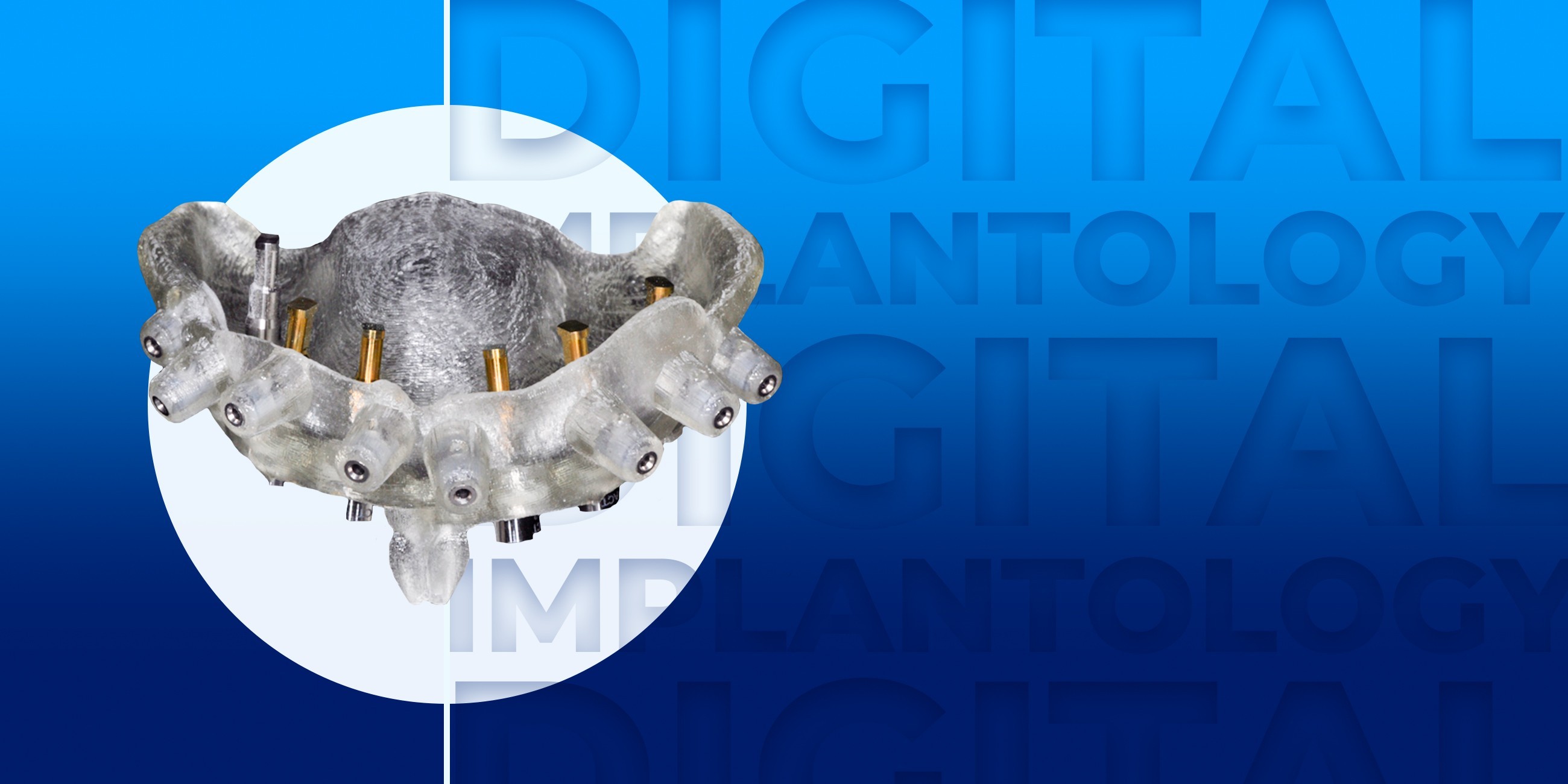 Webinar on introduction to digital implantology, Scanbody