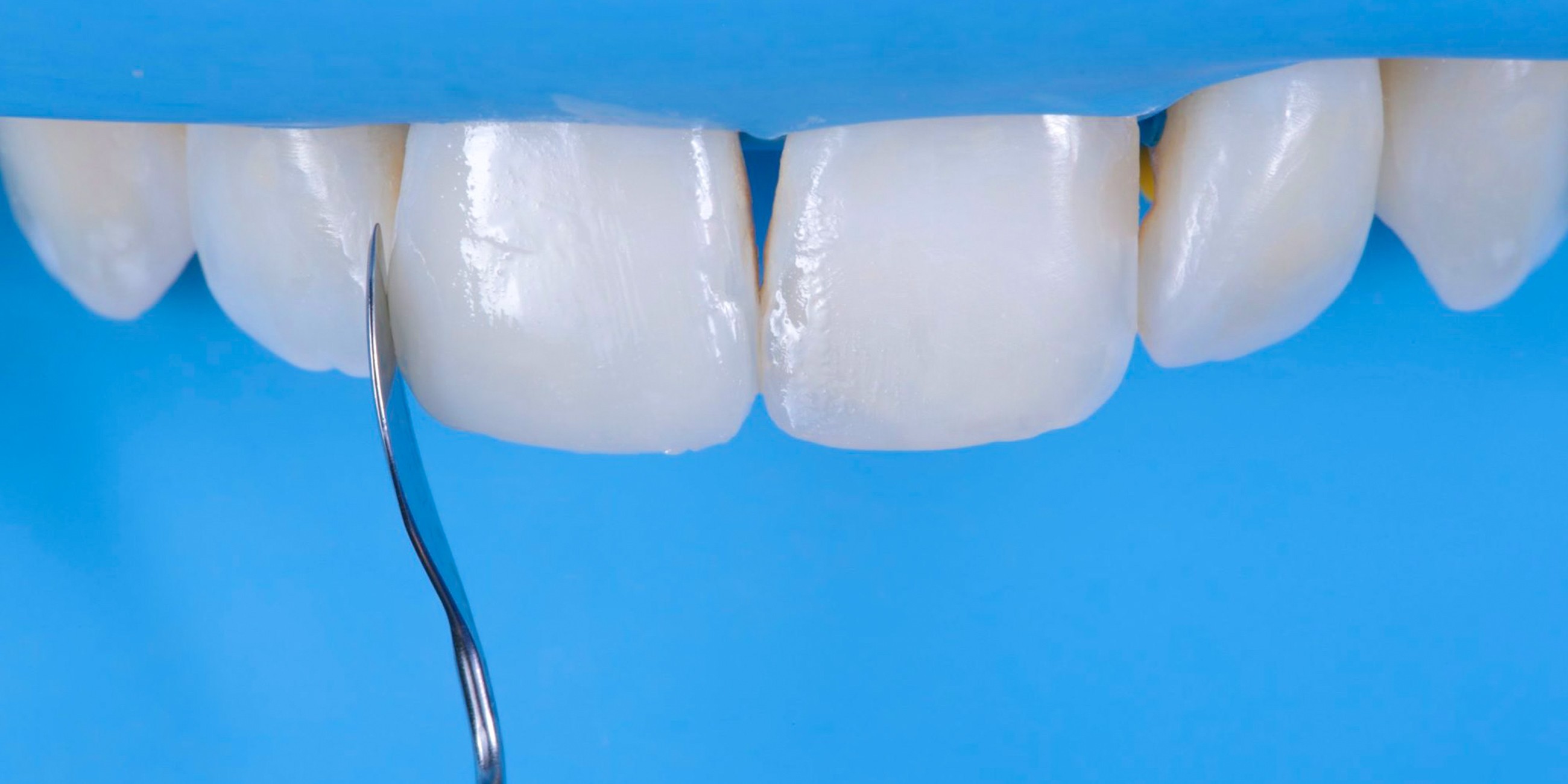 Deep Margin Elevation techniques, isolation, online course