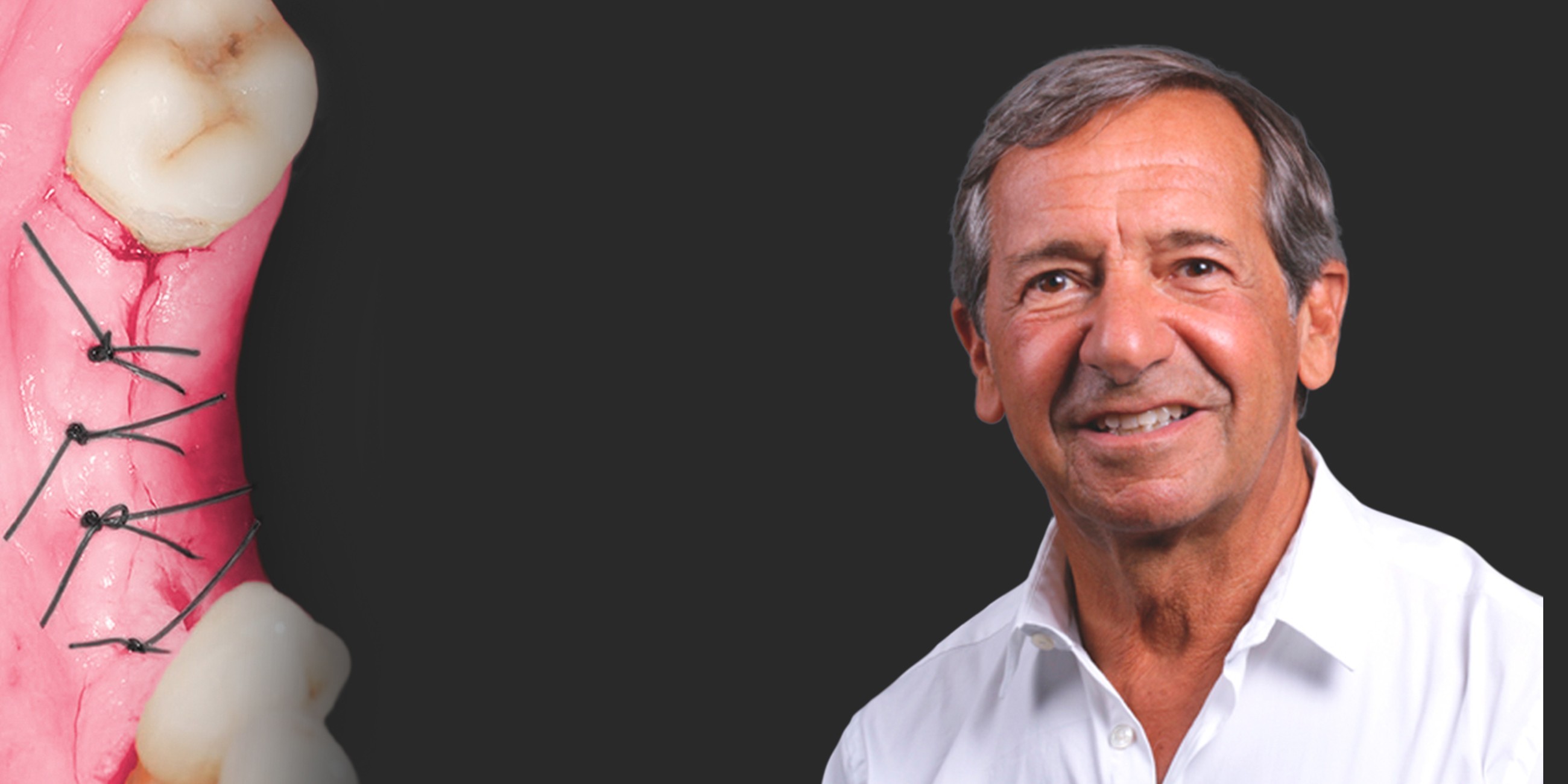 Patrick Palacci online course: guided surgery, implantation