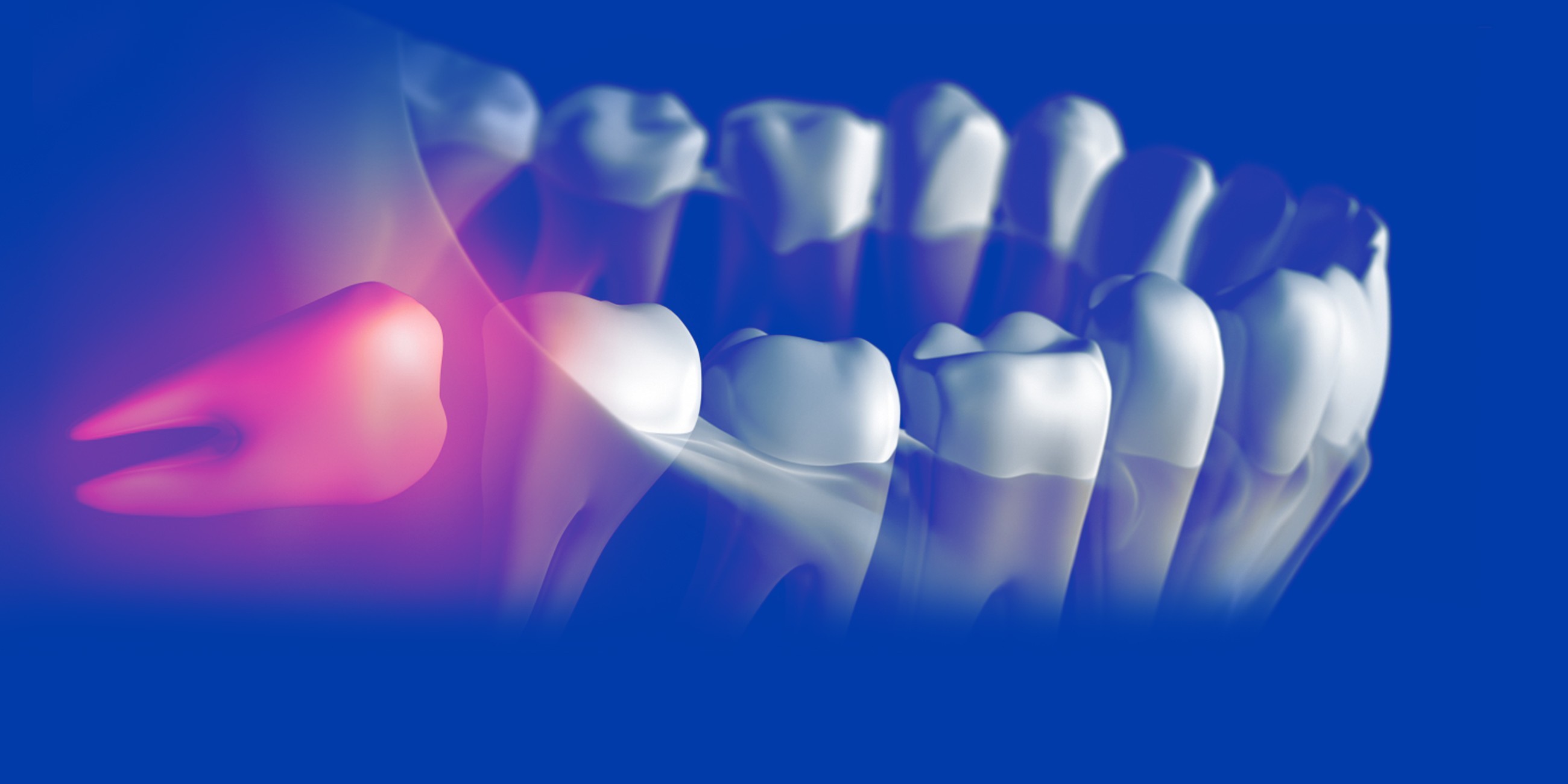 Diagnostico, manejo y prevencion de complicaciones en cirugia extractiva