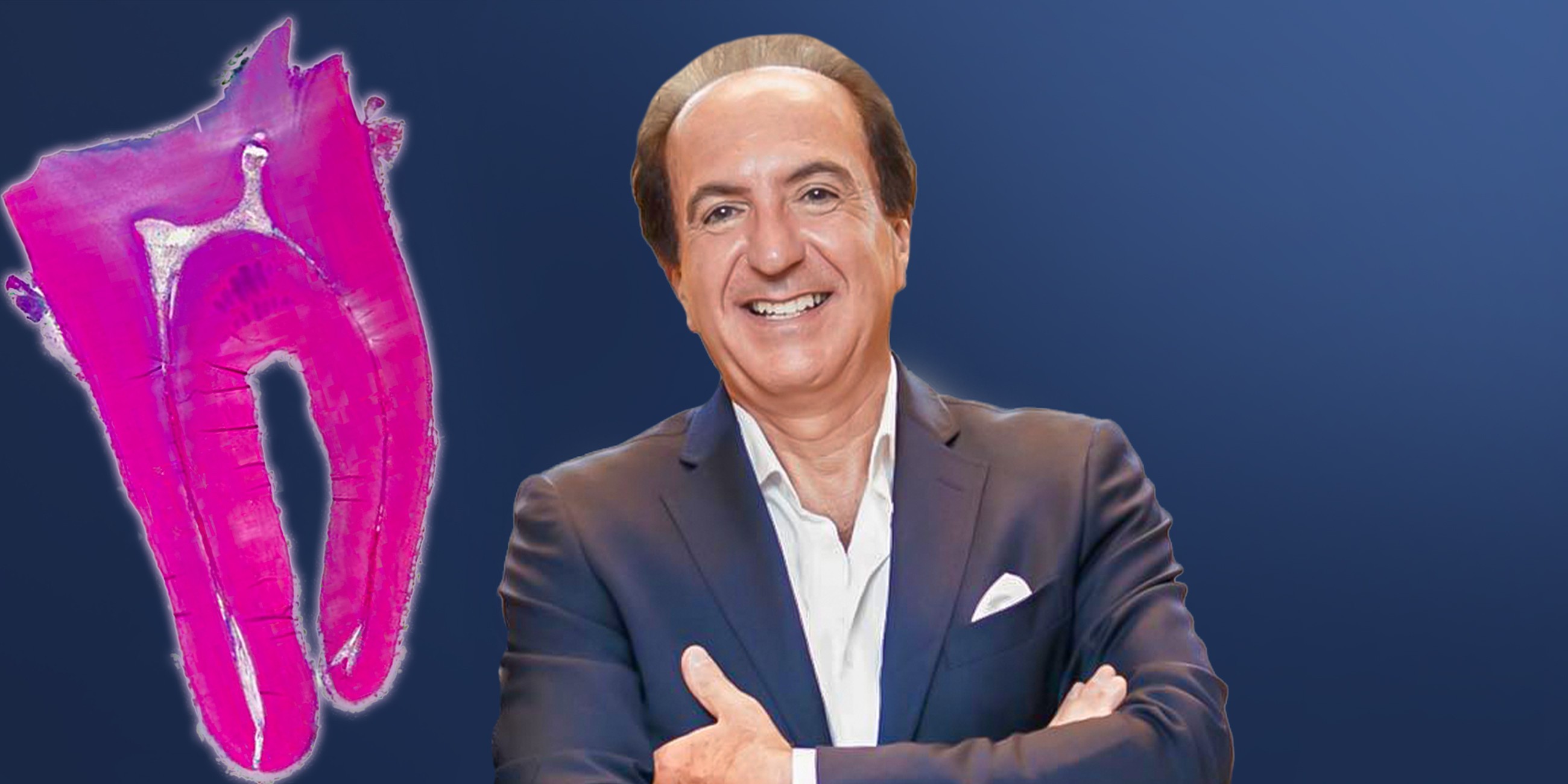 Webinar on deep caries lesions treatment, vital pulp therapy