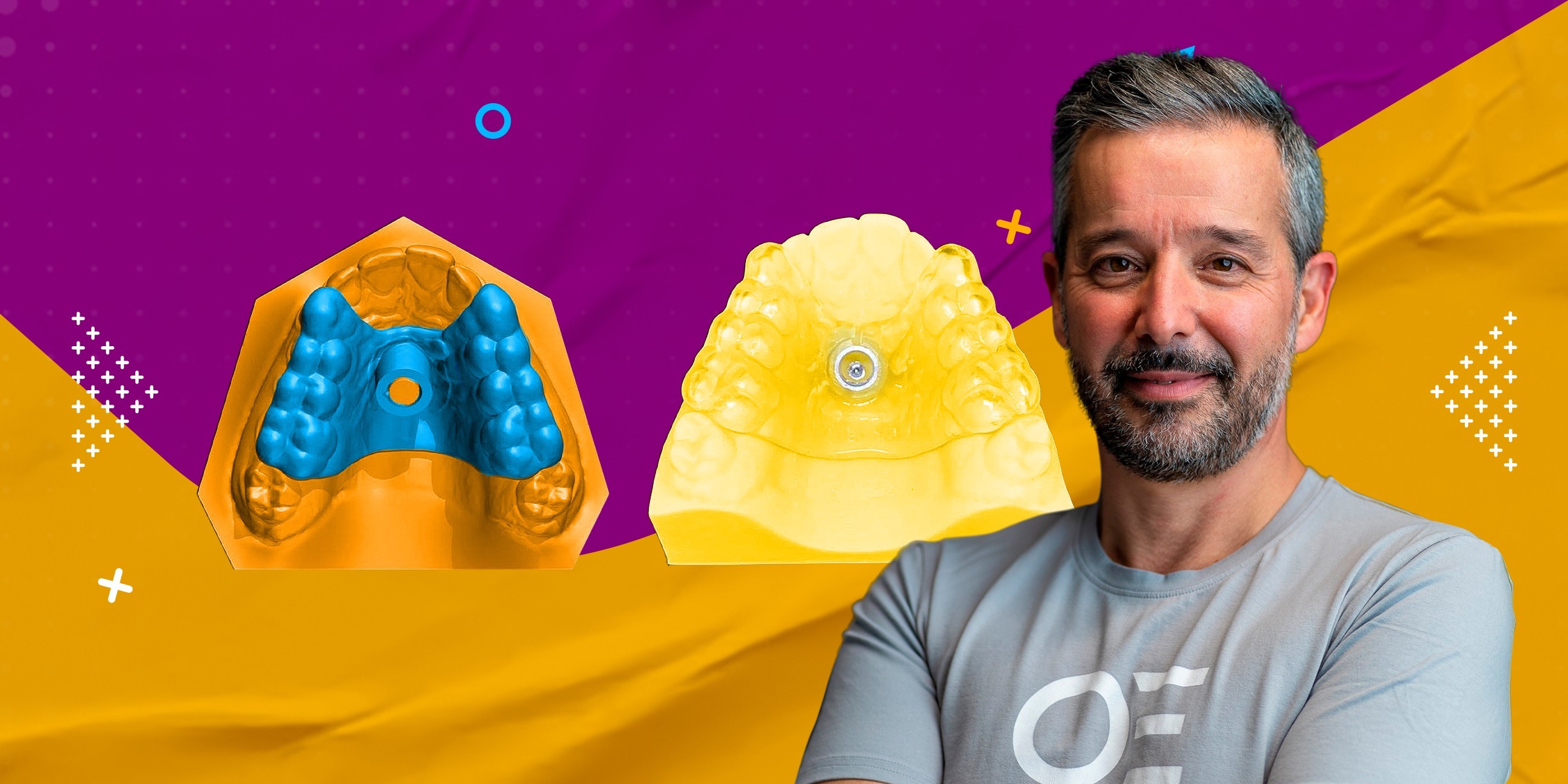 Webinar on Bone Borne RME, direct method, digital protocol