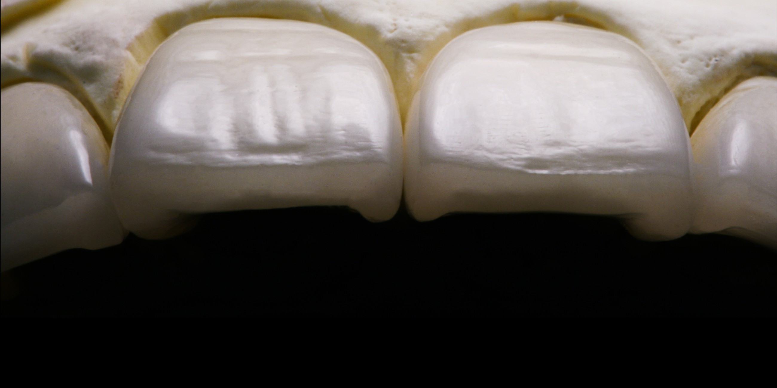 Works with occlusion and cervical spine. Splint therapy