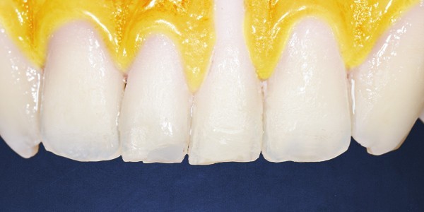 Intensive Course in Periodontology by Anton Sculean: Plastic Aesthetic ...