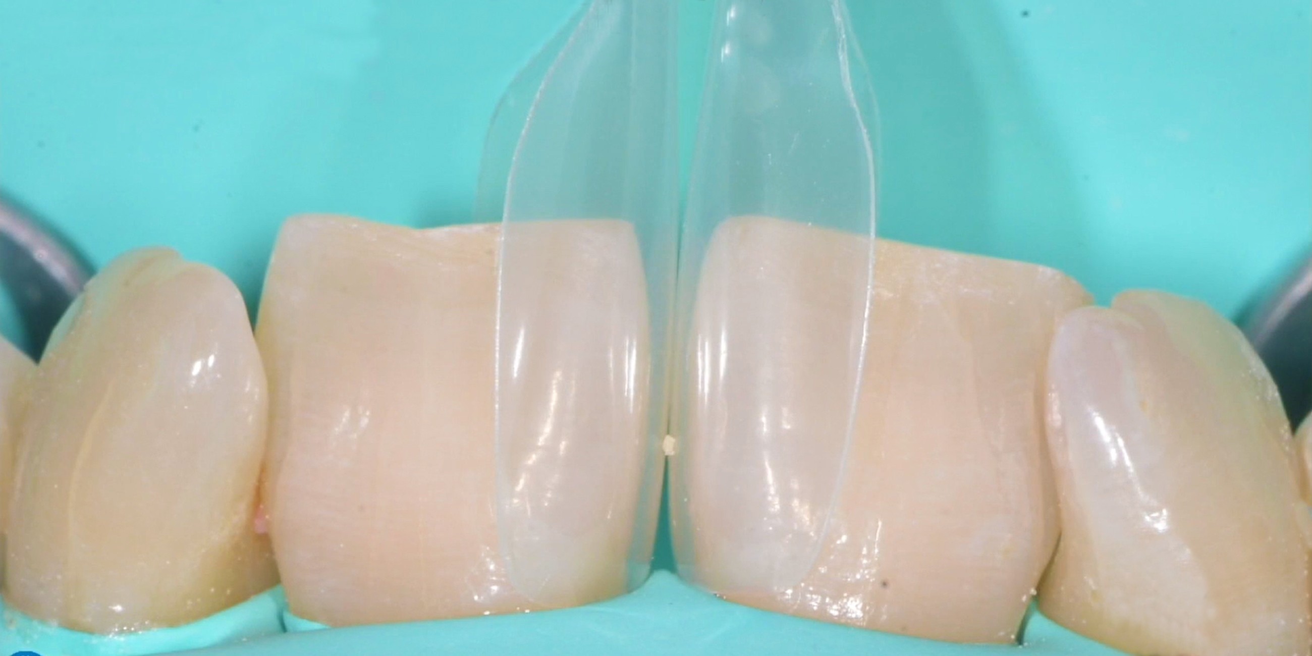 Bioclear. Theory and Practical Sessions with Dr. Marco Maiolino