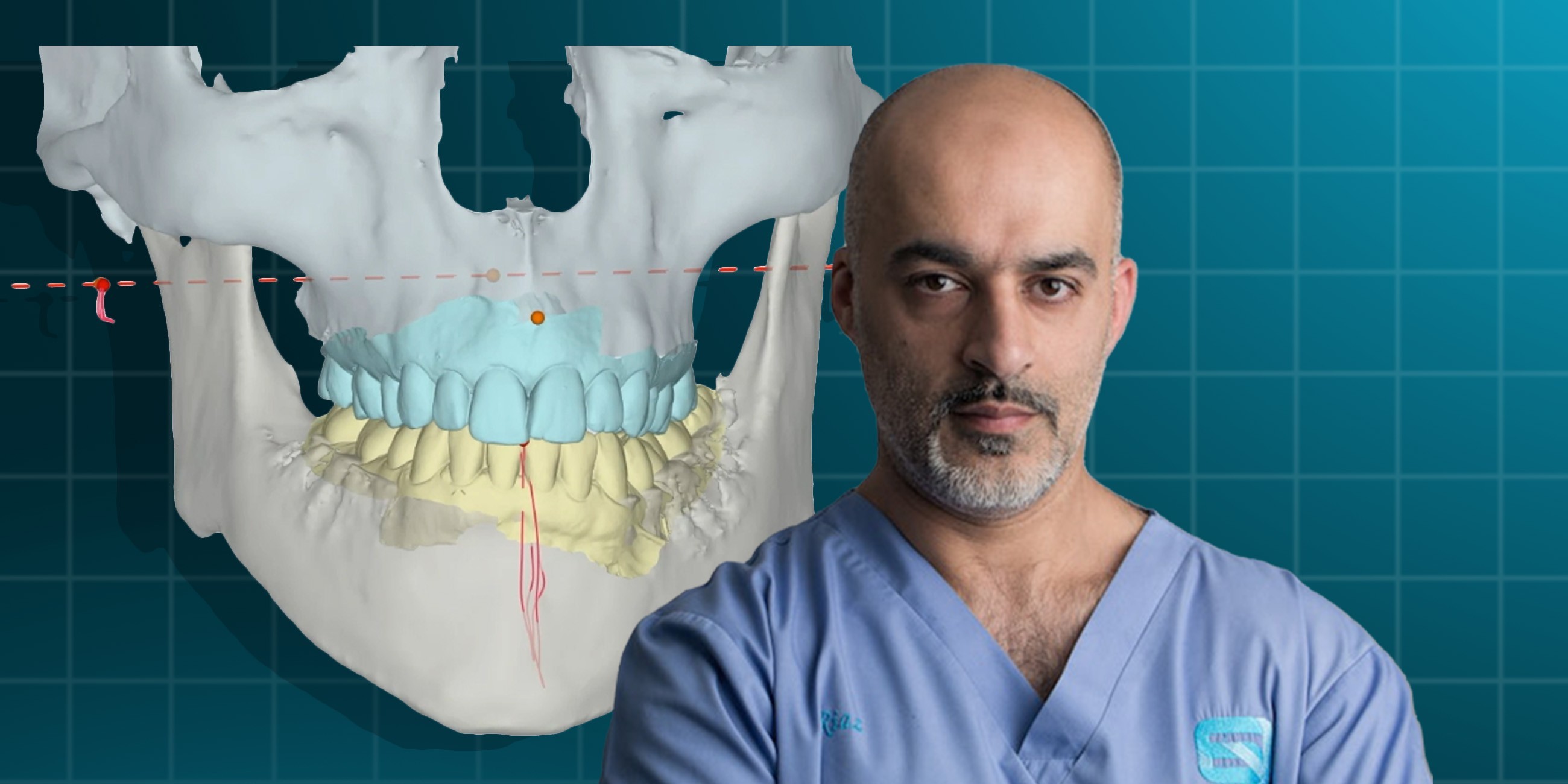 TMJ and Occlusion. Digital Occlusion diagnosis