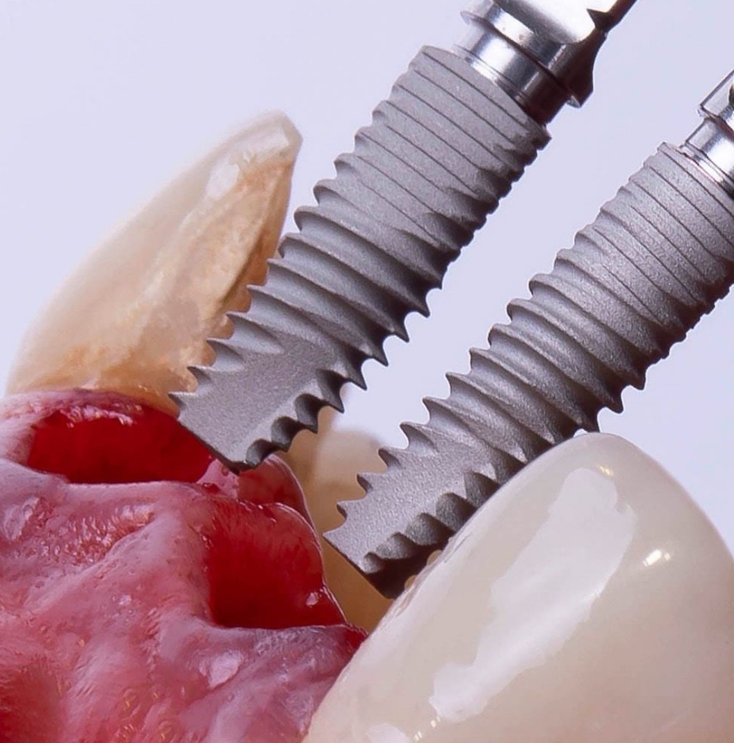 Webinar course CBCT evaluation for implant dentistry