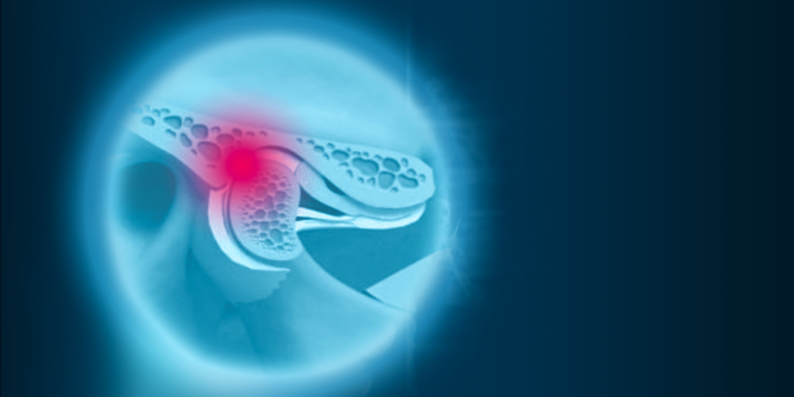 Treatment of TMD: open surgery