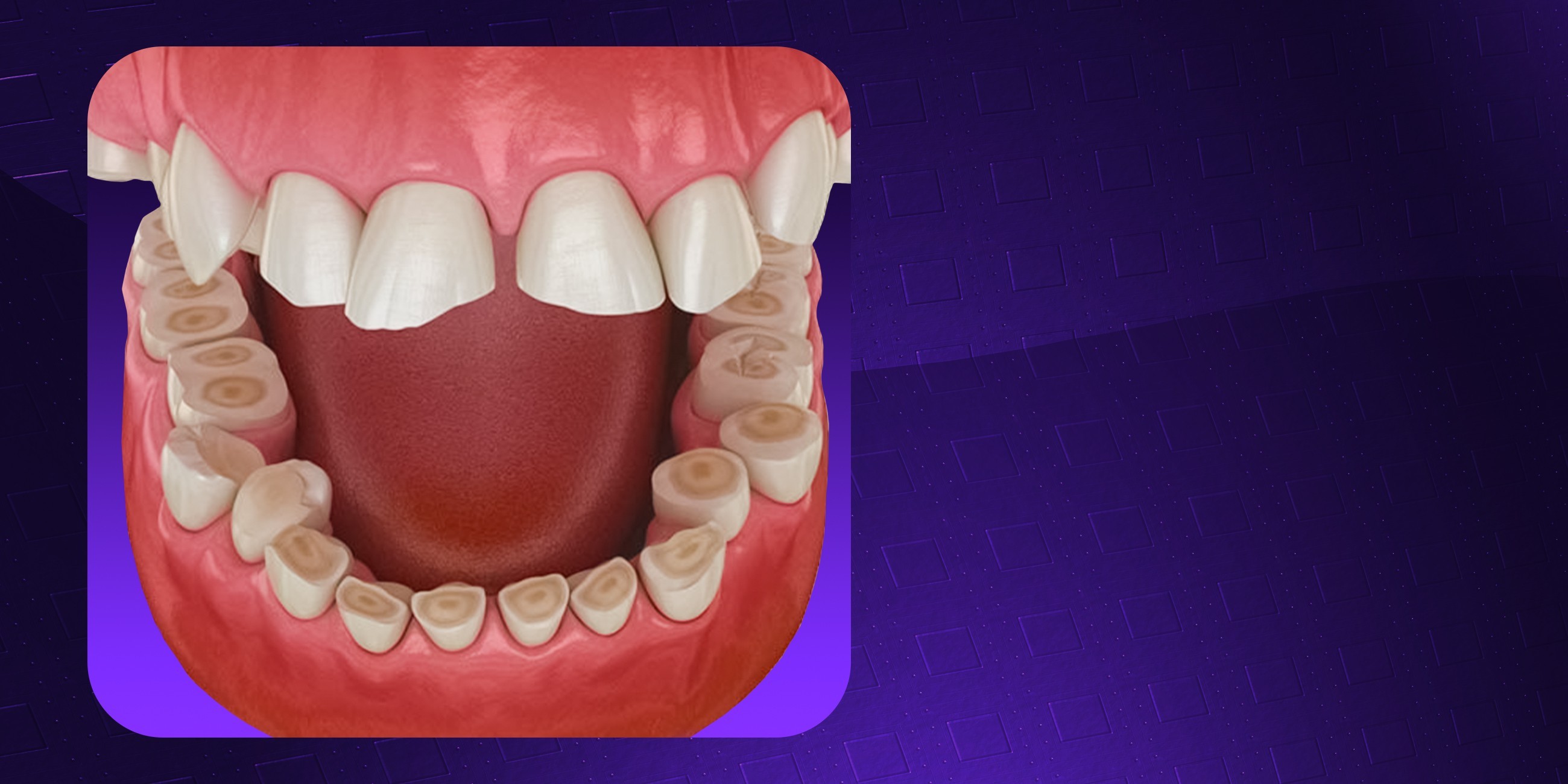 True definition of tooth wear: classification and diagnosis