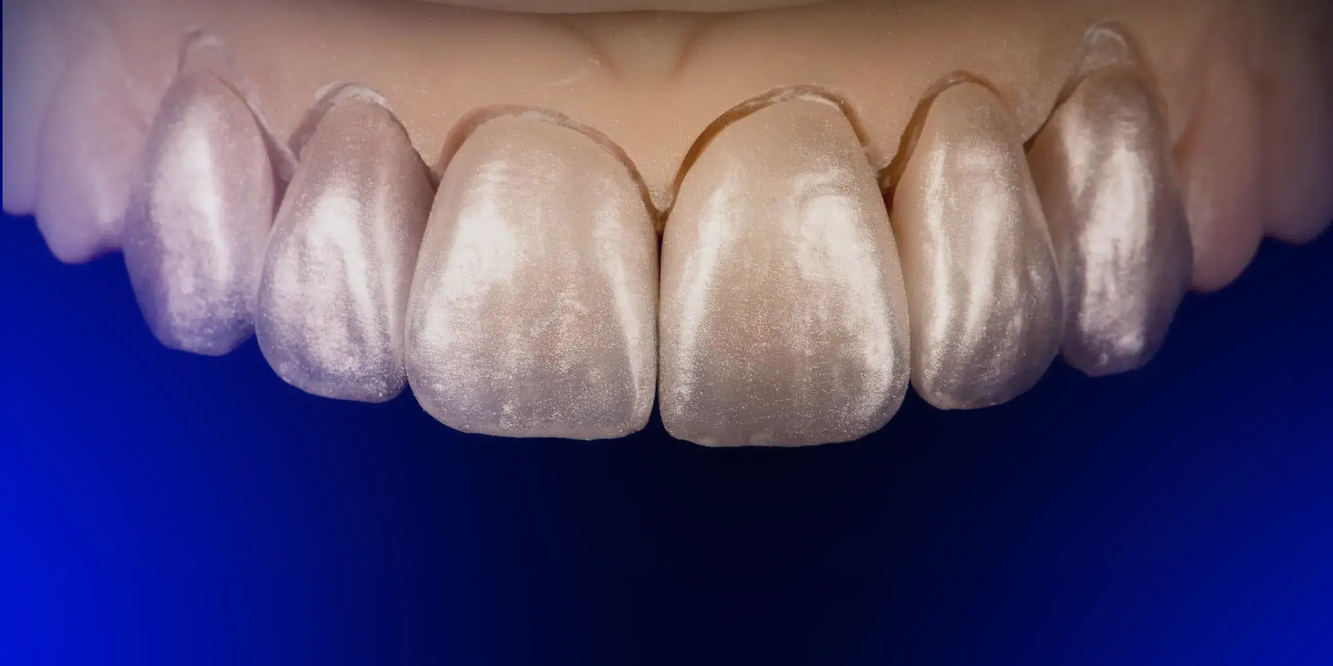 10 сommon mistakes and how to correct them with BOPT technique for ...