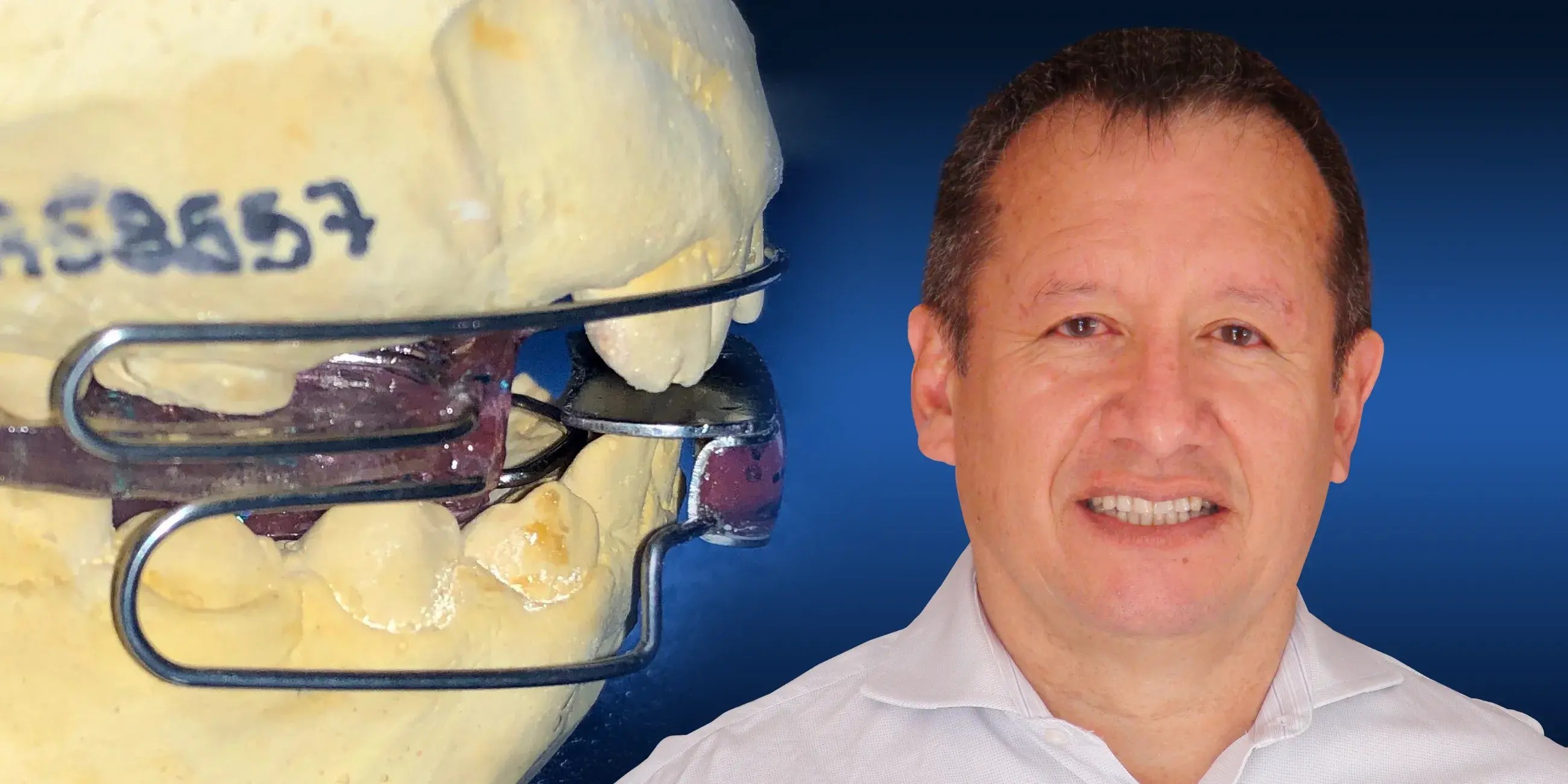 Aparatos de ortodoncia funcionales. Curso gratuito de Carlos Barberi