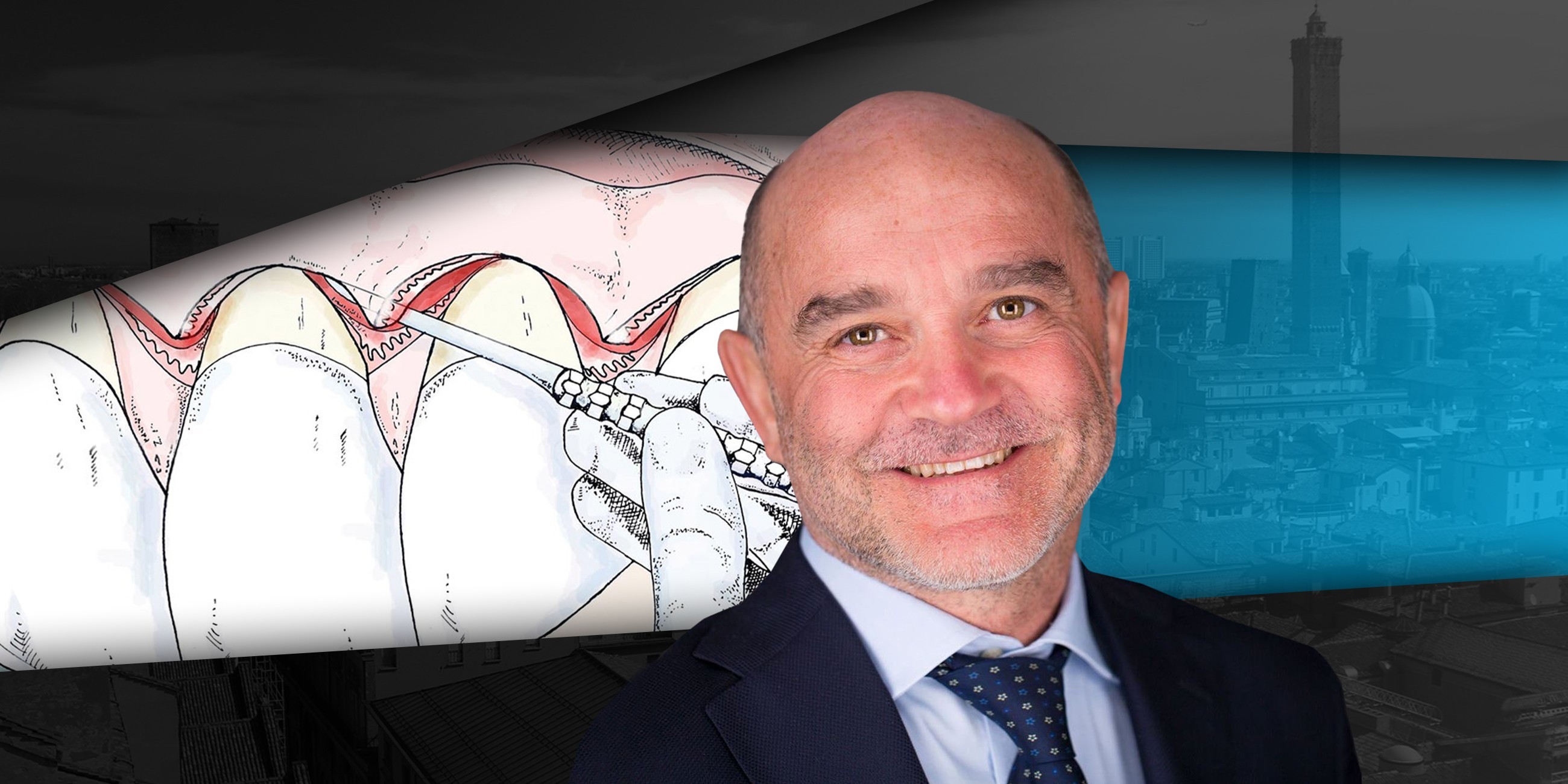 Videos from a demonstration of Professor Giovanni Zucchelli's ...