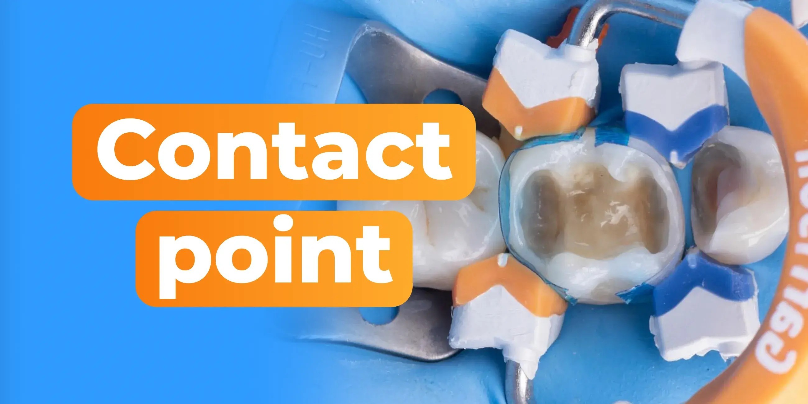 Contact point: effective posterior teeth direct restoration technique