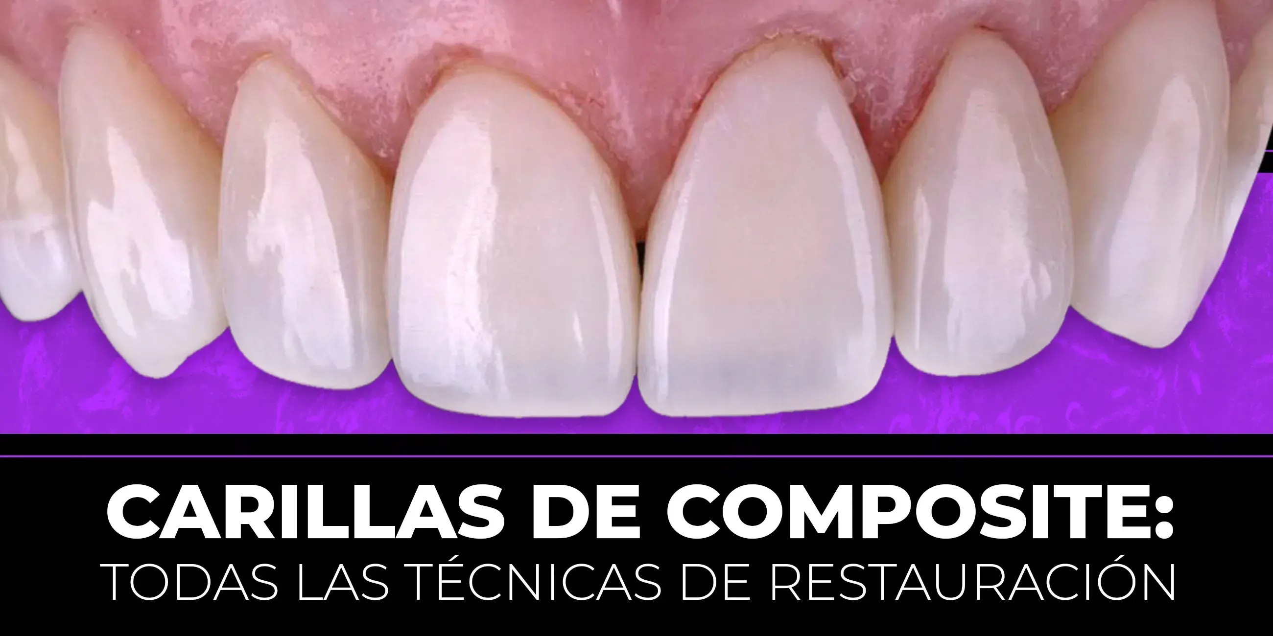 Técnica de inyección