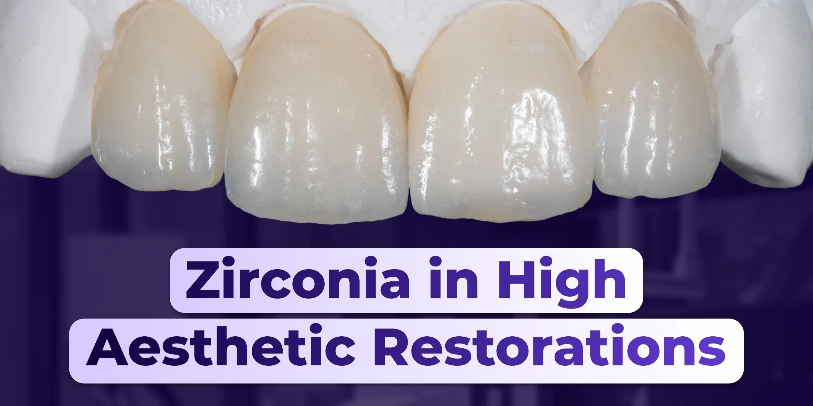 Zirconia Crown Restoration: Step-by-Step Video Recording of Preparation ...