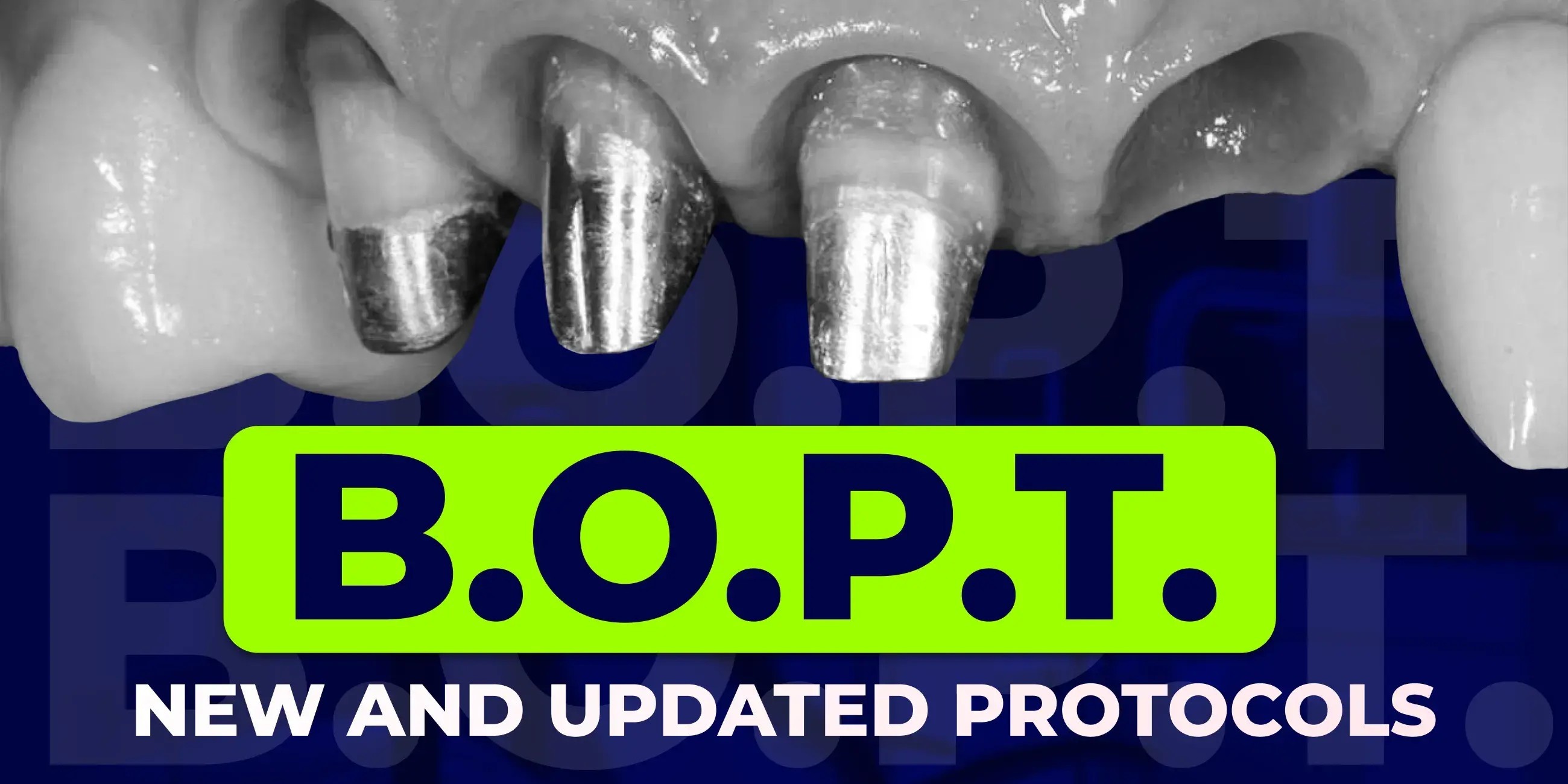 BOPT Concept Encyclopedia – Online Course For Prosthodontists and ...