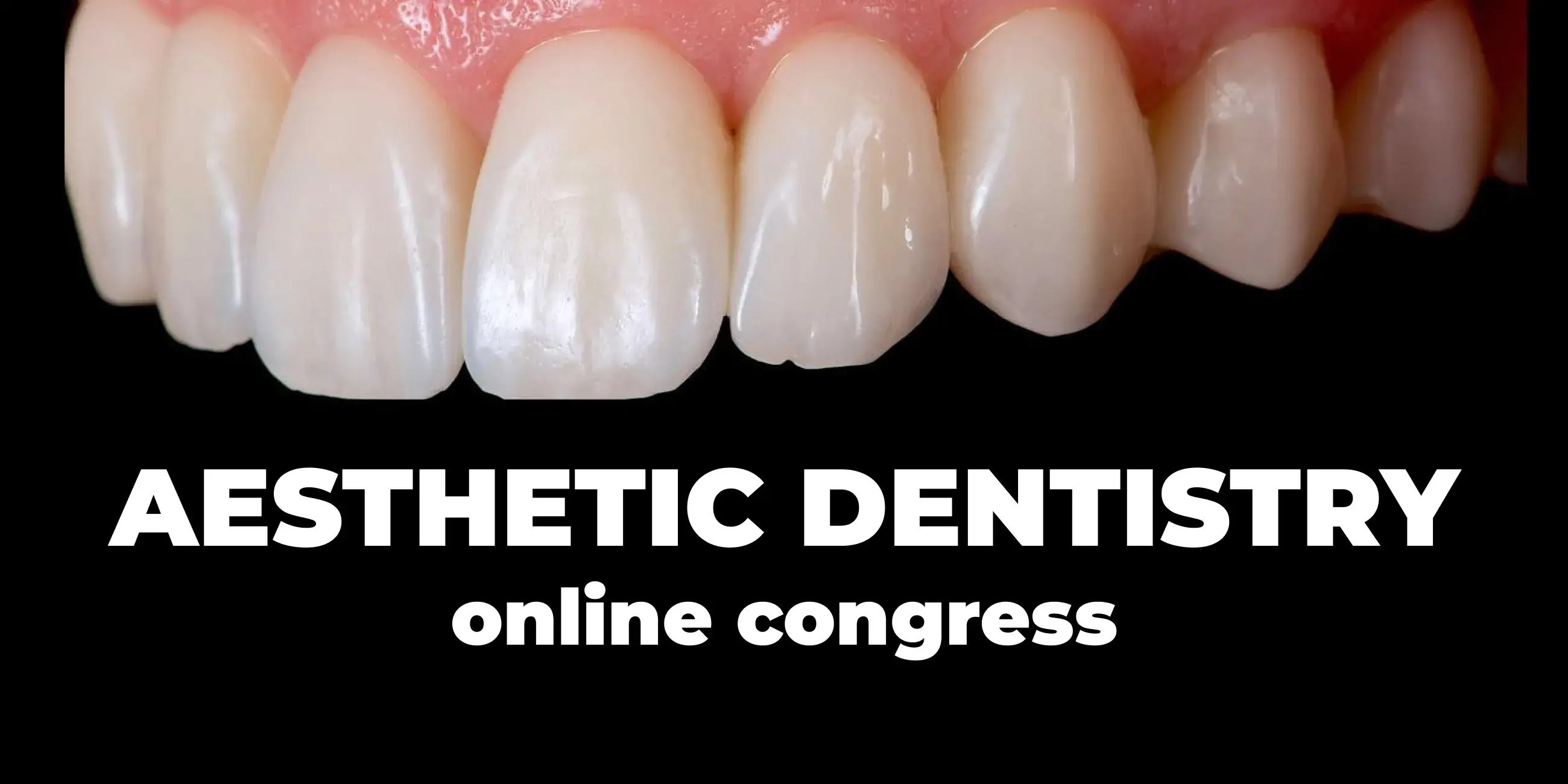 Edge and Edgeless Preparation in Perio-Restorative Cases