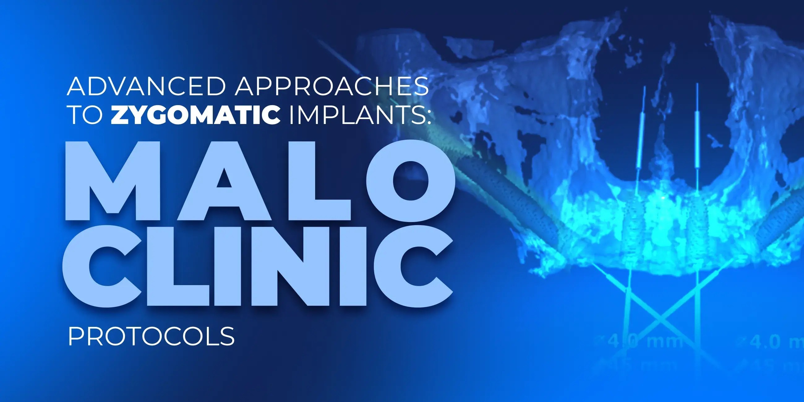 Advanced Approaches to Zygomatic Implants: MALO Clinic Protocols