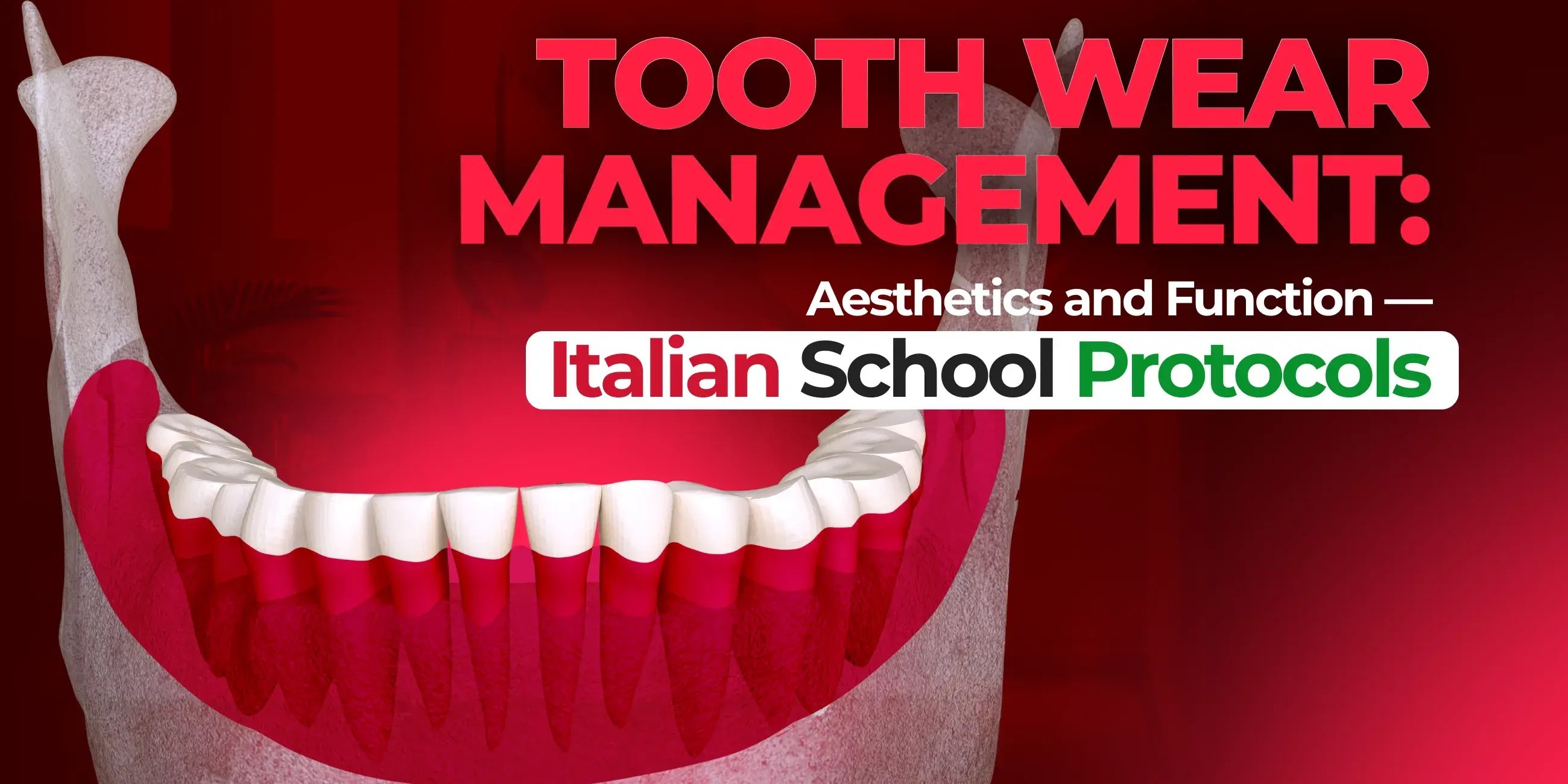 Tooth Wear Management: Italian Protocols - Online Course | 9,75 CE Credits