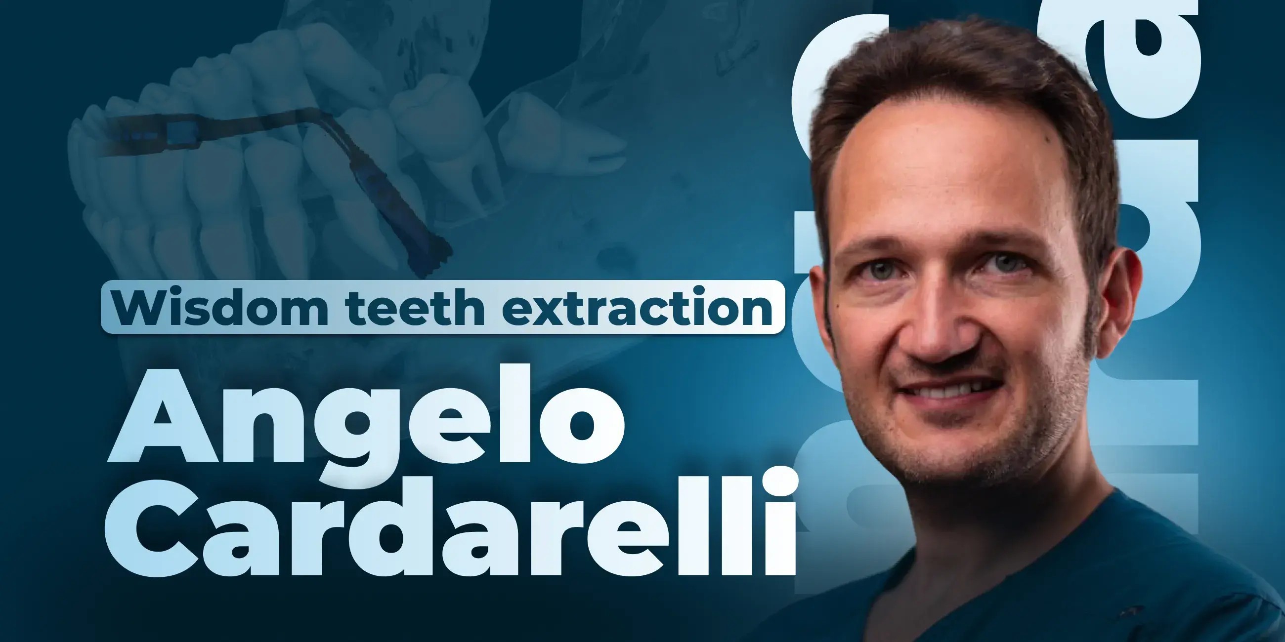 Online course on complex removal wisdom teeth extraction