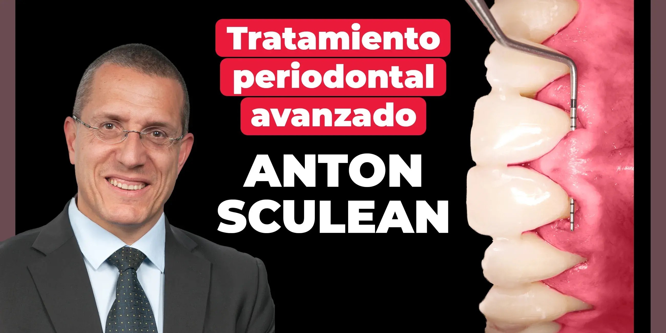 Conceptos clinicos para la cirugia periodontal regenerativa en defectos ...