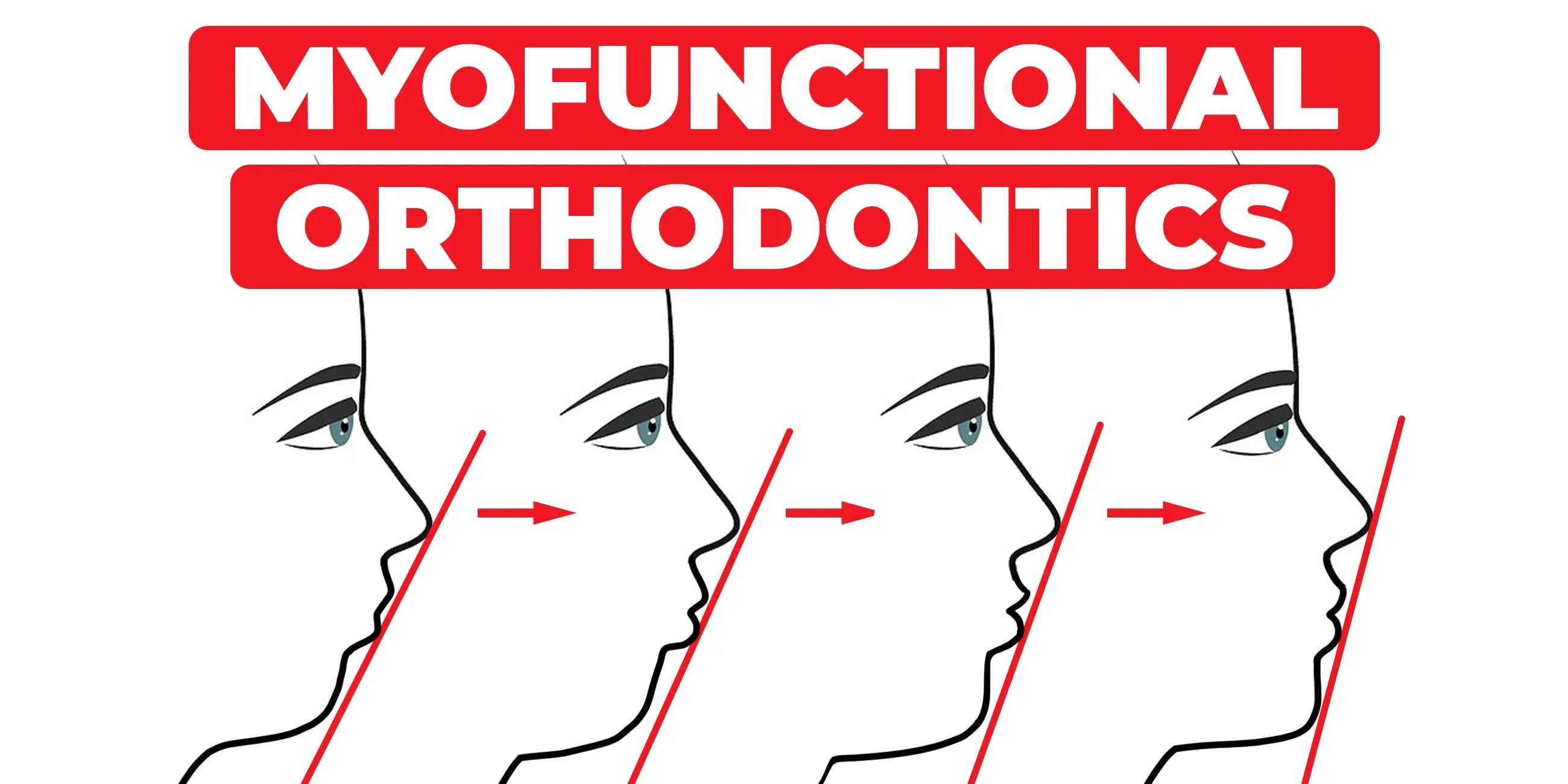 The Neuroscience Behind Pediatric Orthodontics and Myofunctional therapy