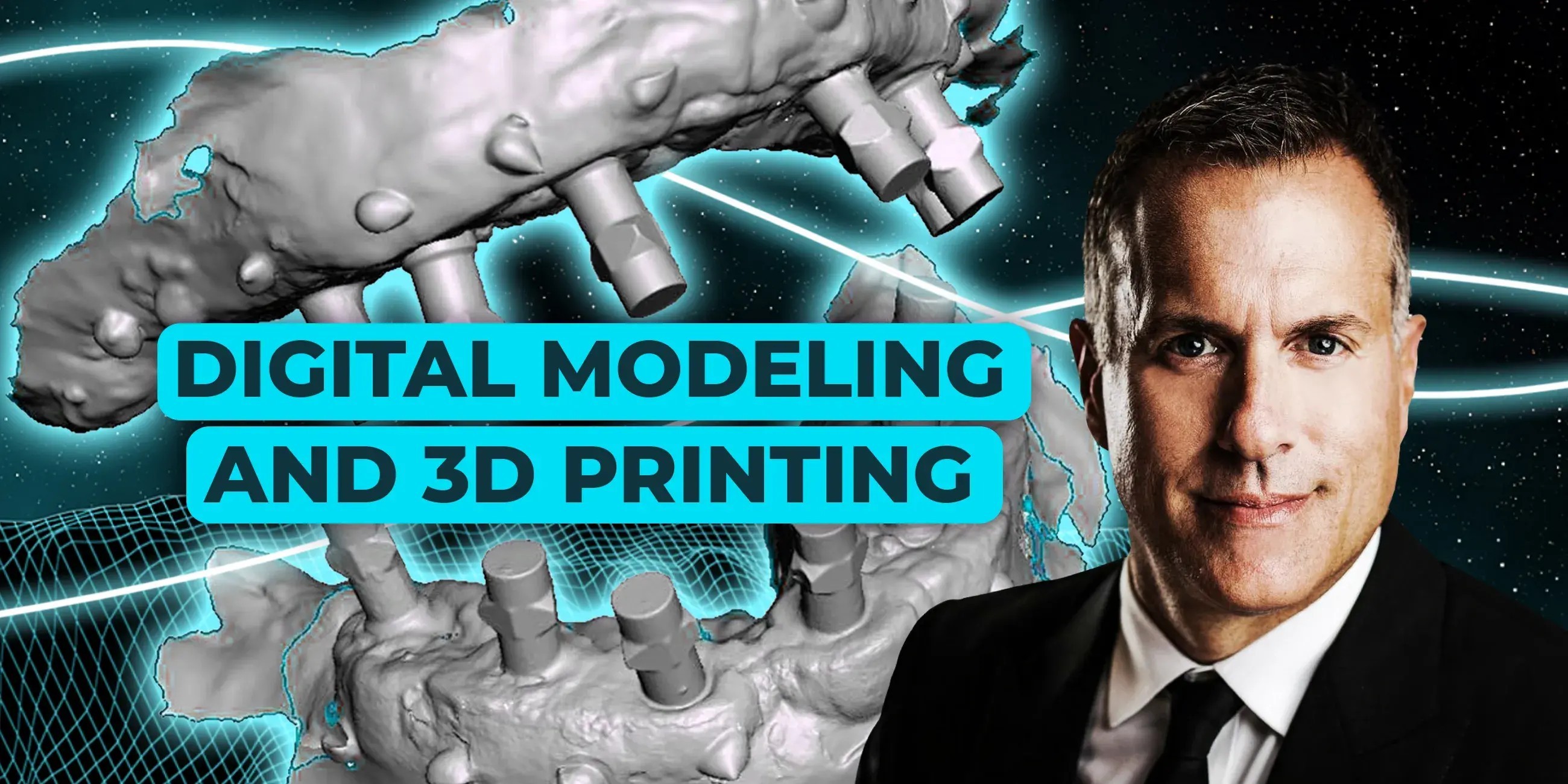 Diagnostic Wax Ups and Virtual Smile Design using BSP. 3D Printed Night ...