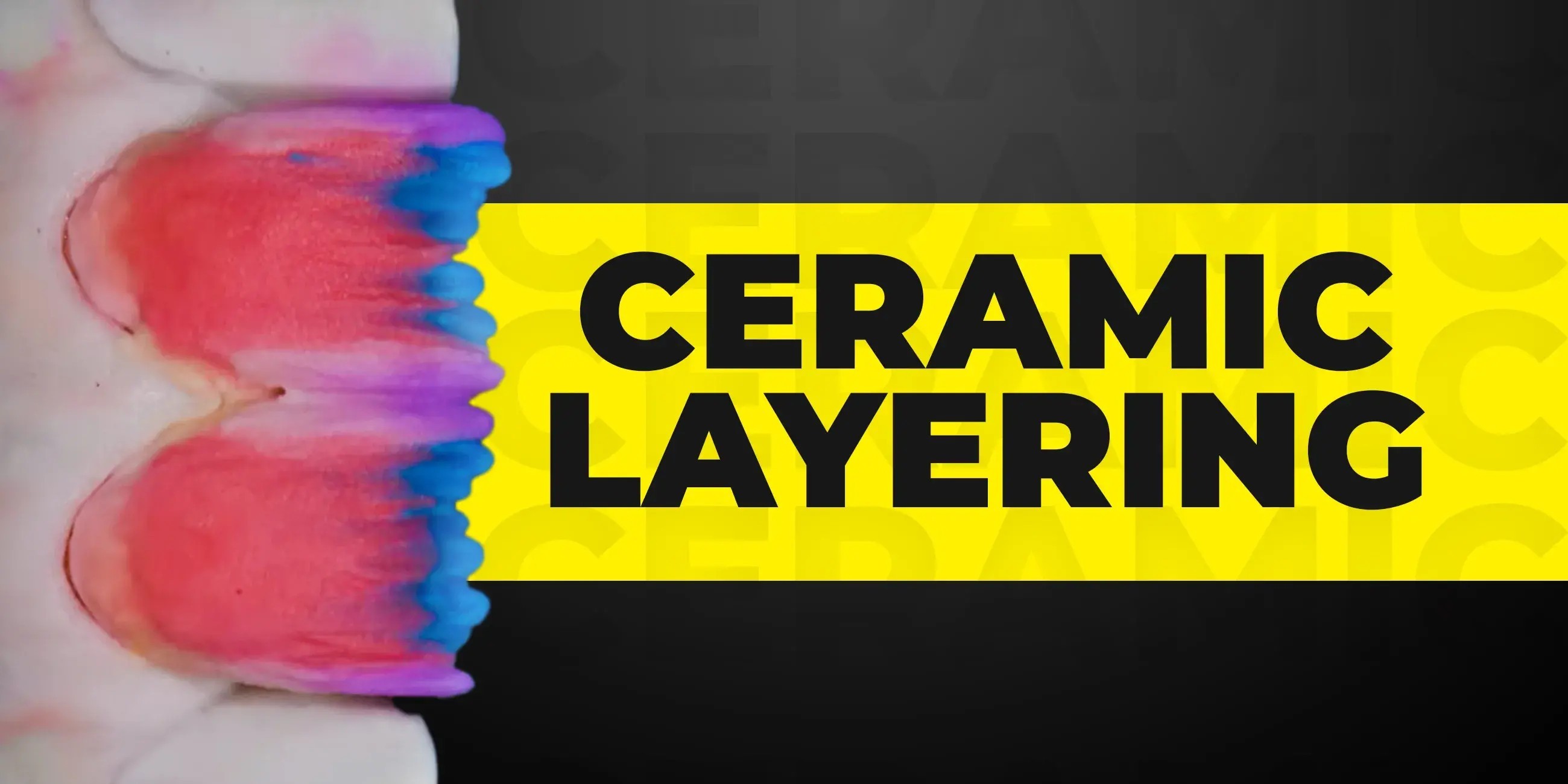 Webinar on demonstration of enamel layer applying technique