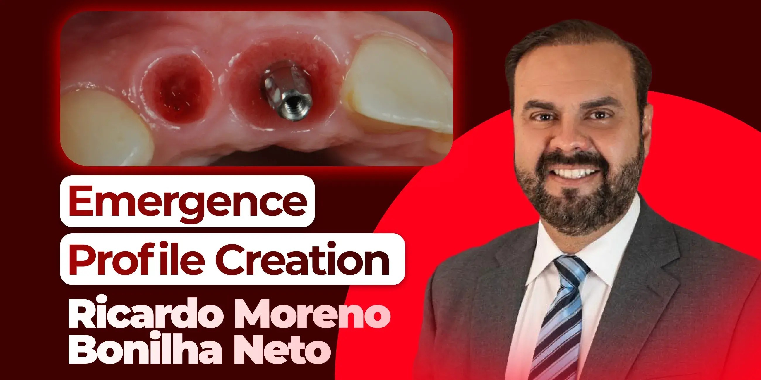 Emergence Profile: Challenges and Possibilities