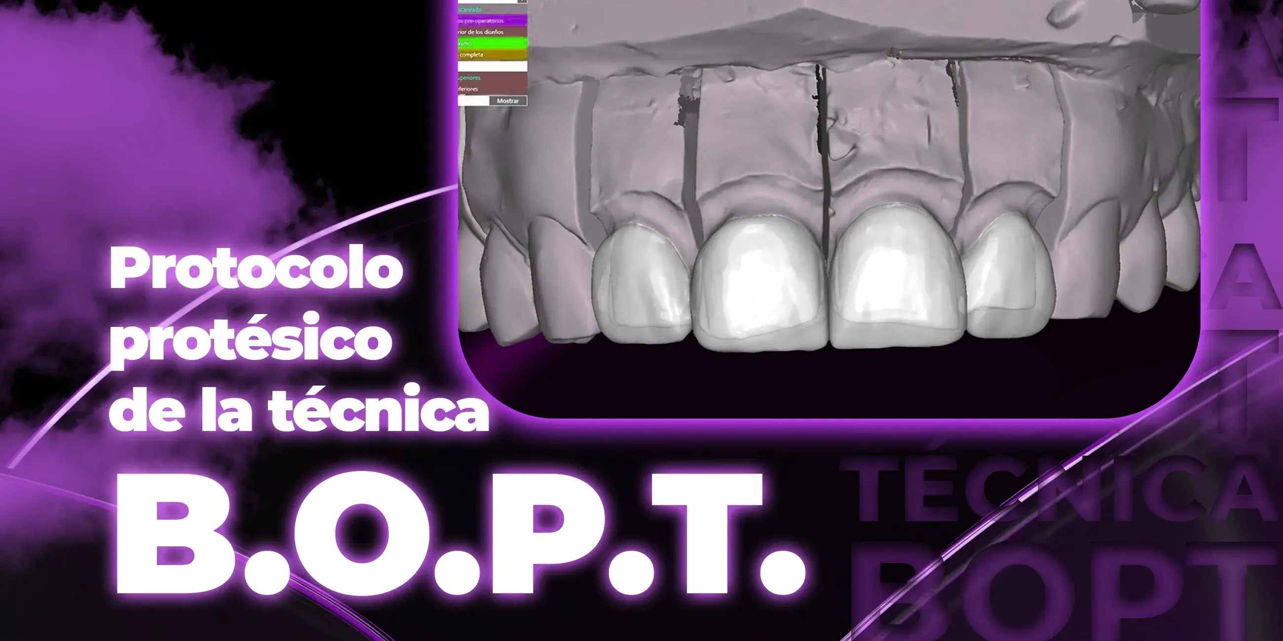 Protocolo Digital-Intraoral